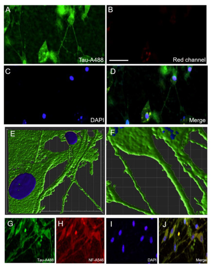 Spreading of P301S Aggregated Tau Investigated in Organotypic Mouse ...
