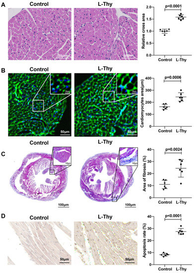 N-Acetylcysteine, an ROS Inhibitor, Alleviates the Pathophysiology of ...