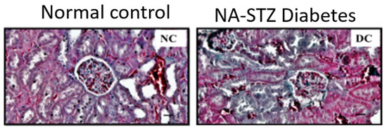 The Nicotinamide/Streptozotocin Rodent Model of Type 2 Diabetes: Renal ...