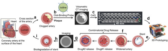 Development of Biodegradable Polymeric Stents for the Treatment of ...