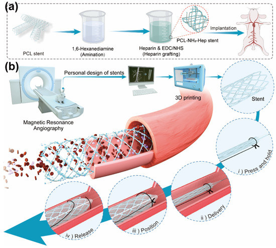 Development of Biodegradable Polymeric Stents for the Treatment of ...
