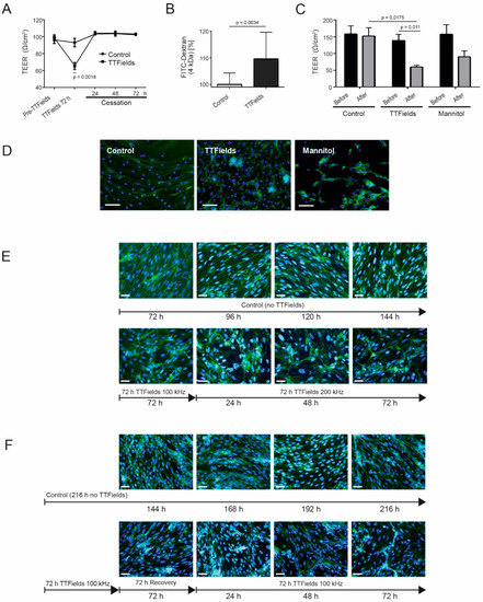 Tumor Treating Fields (TTFields) Reversibly Permeabilize the Blood ...