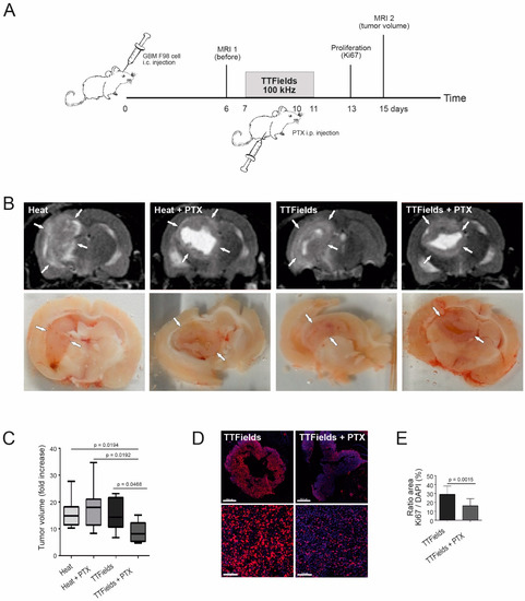 Tumor Treating Fields (TTFields) Reversibly Permeabilize the Blood ...