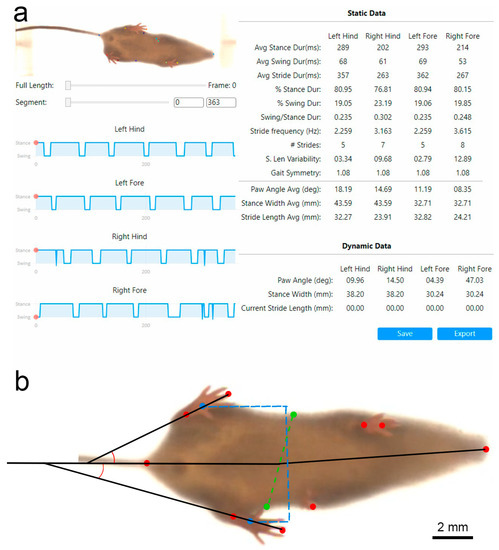Functional Gait Assessment Using Manual, Semi-Automated and Deep Learning Approaches Following ...