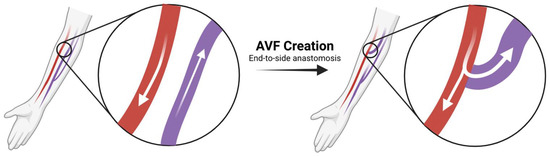 Localized Perivascular Therapeutic Approaches to Inhibit Venous ...