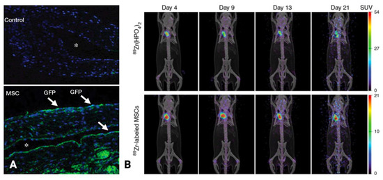 Localized Perivascular Therapeutic Approaches to Inhibit Venous ...
