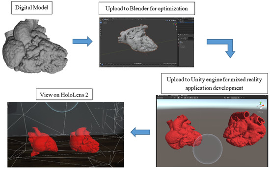 Clinical Applications of Mixed Reality and 3D Printing in Congenital ...