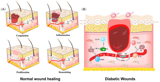 Advances in the Preparation of Nanofiber Dressings by Electrospinning ...