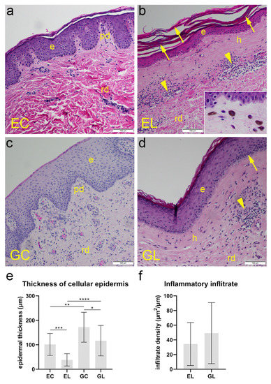 The Distribution of Innervation and Immune Cell Infiltration Is ...