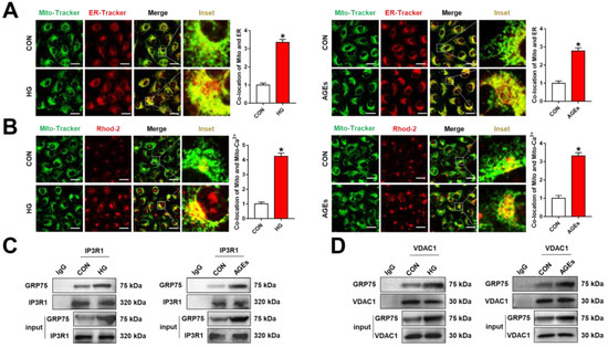 GRP75 Modulates Endoplasmic Reticulum–Mitochondria Coupling and ...