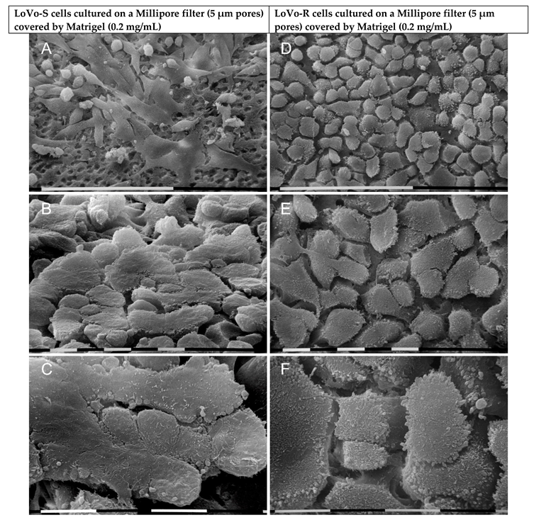Substrate Type and Concentration Differently Affect Colon Cancer Cells ...