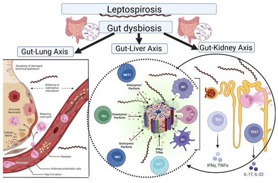 Weil’s Disease—Immunopathogenesis, Multiple Organ Failure, and ...