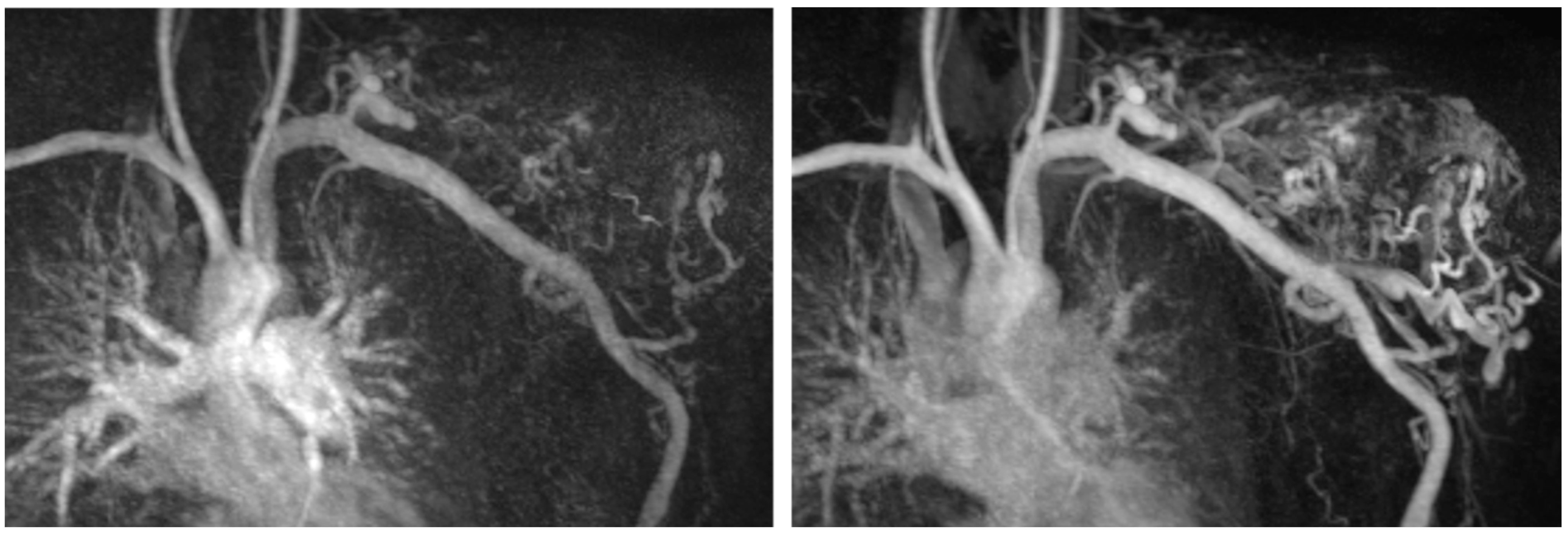 Comprehensive Analyses of Coagulation Parameters in Patients with ...