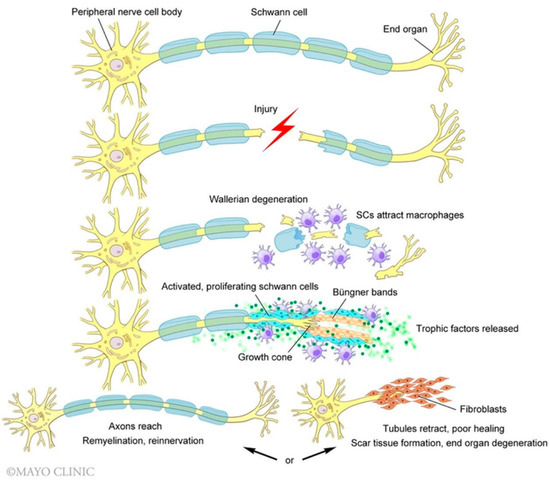 The Effect of Electrical Stimulation on Nerve Regeneration Following ...