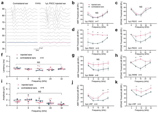 Approaches and Vectors for Efficient Cochlear Gene Transfer in Adult ...