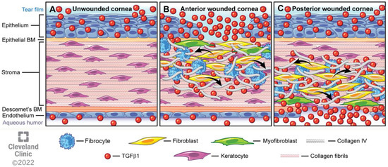 The Yin and Yang of Mesenchymal Cells in the Corneal Stromal Fibrosis ...