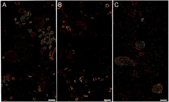 Biomolecules | Free Full-Text | Assessment of Fibrinogen-like 2 (FGL2 ...