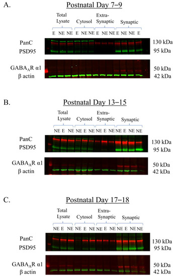 Developmental Inhibitory Changes in the Primary Somatosensory Cortex of ...