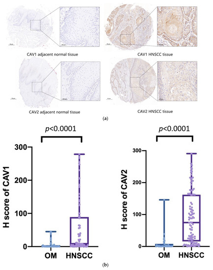 Prognostic Value of CAV1 and CAV2 in Head and Neck Squamous Cell Carcinoma