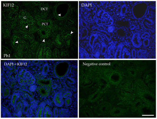 Spatio-Temporal Expression Pattern of CAKUT Candidate Genes DLG1 and ...