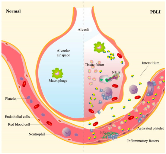 Biomolecules | Free Full-Text | Crosstalk between Inflammation and Hemorrhage/Coagulation ...