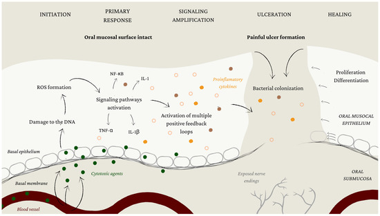 Photobiomodulation for Chemotherapy-Induced Oral Mucositis in Pediatric ...