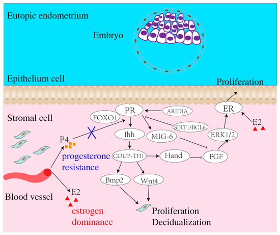 Towards a Better Understanding of Endometriosis-Related Infertility: A ...