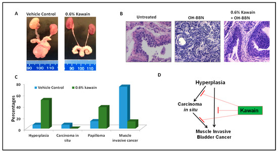 Kawain Inhibits Urinary Bladder Carcinogenesis through Epigenetic ...