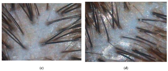 Biomolecules of Fermented Tropical Fruits and Fermenting Microbes as ...