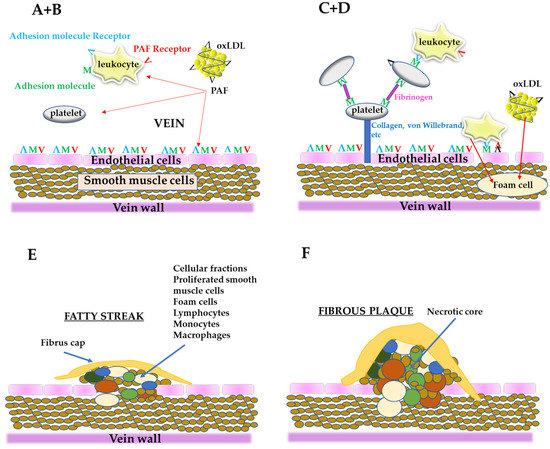 Protective Effect of Olive Oil Microconstituents in Atherosclerosis ...