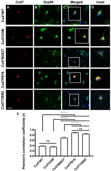 Mechanisms of Diseases Associated with Mutation in GJC2/Connexin 47