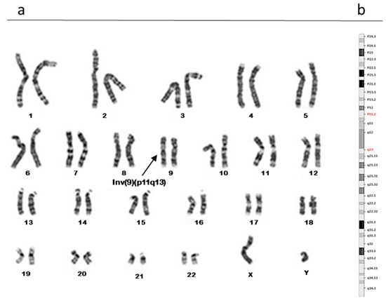 Polymorphic Rearrangements of Human Chromosome 9 and Male Infertility: New Evidence and Impact ...