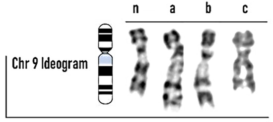 Polymorphic Rearrangements of Human Chromosome 9 and Male Infertility ...