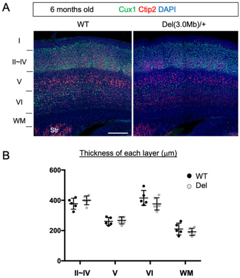 Histological Analysis of a Mouse Model of the 22q11.2 Microdeletion ...