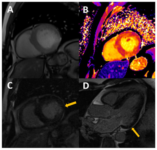Cardiac Imaging Biomarkers in Chronic Kidney Disease
