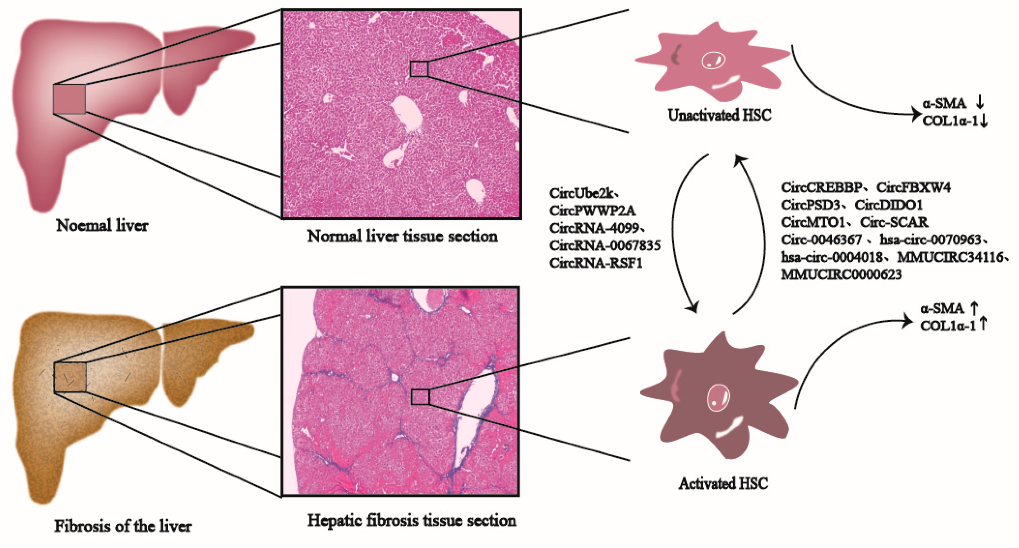 Overview of CircRNAs Roles and Mechanisms in Liver Fibrosis