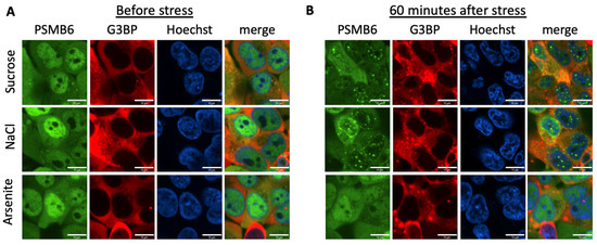 Method of Monitoring 26S Proteasome in Cells Revealed the Crucial Role ...