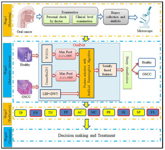 Biomolecules | Free Full-Text | OralNet: Fused Optimal Deep Features Framework for Oral Squamous ...