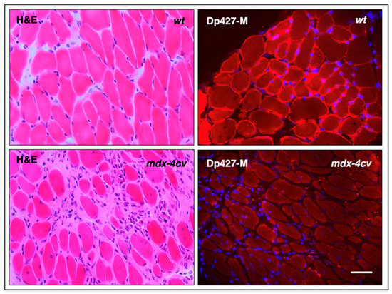 Extracellular Matrix Proteomics: The mdx-4cv Mouse Diaphragm as a ...