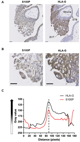 An Extracellular/Membrane-Bound S100P Pool Regulates Motility and ...