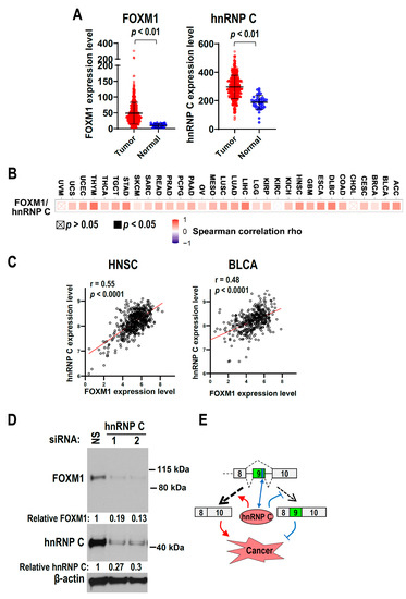 FOXM1a Isoform of Oncogene FOXM1 Is a Tumor Suppressor Suppressed by ...