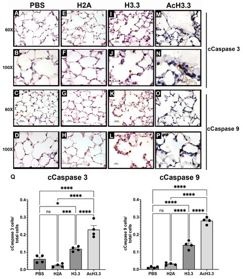 Extracellular Acetylated Histone 3.3 Induces Inflammation and Lung ...