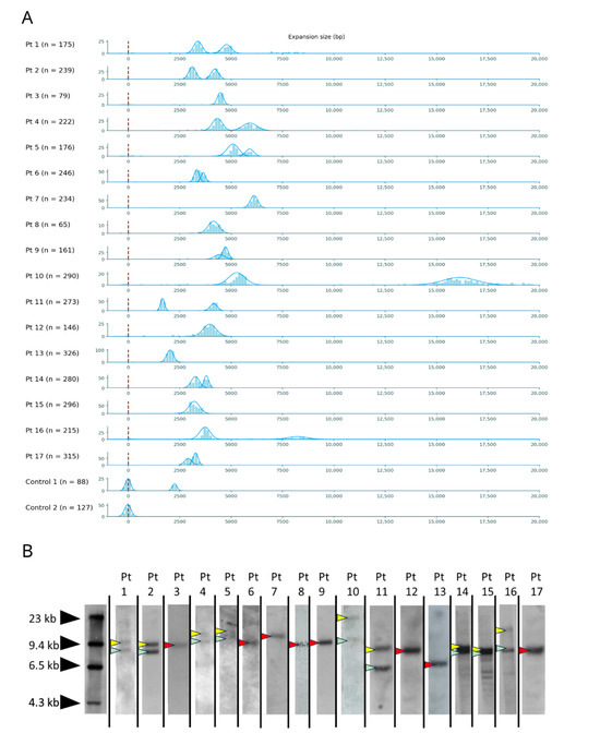 Optical Genome Mapping Enables Detection and Accurate Sizing of RFC1 ...