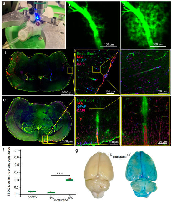 Biomolecules | Free Full-Text | Machine Learning Technology for EEG ...