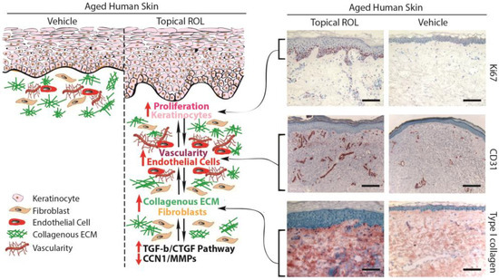 Human Skin Aging and the Anti-Aging Properties of Retinol