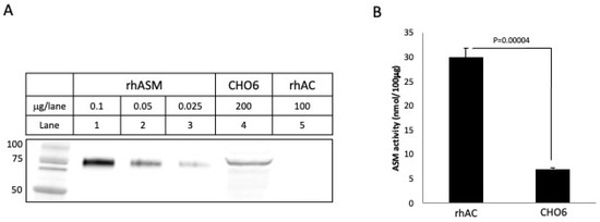 Identification of a Novel Acid Sphingomyelinase Activity Associated ...
