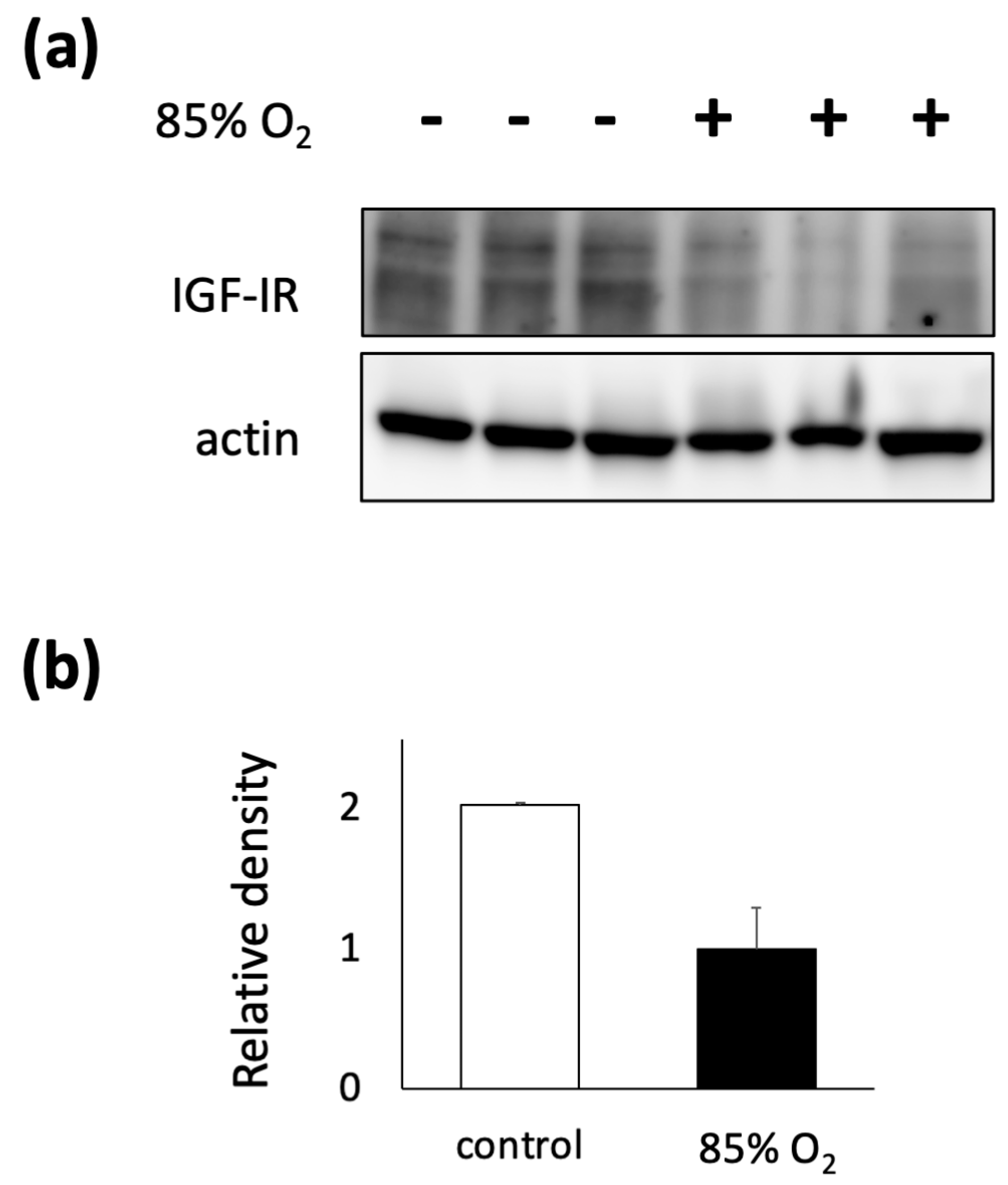 Furin Regulates the Alveolarization of Neonatal Lungs in a Mouse Model ...