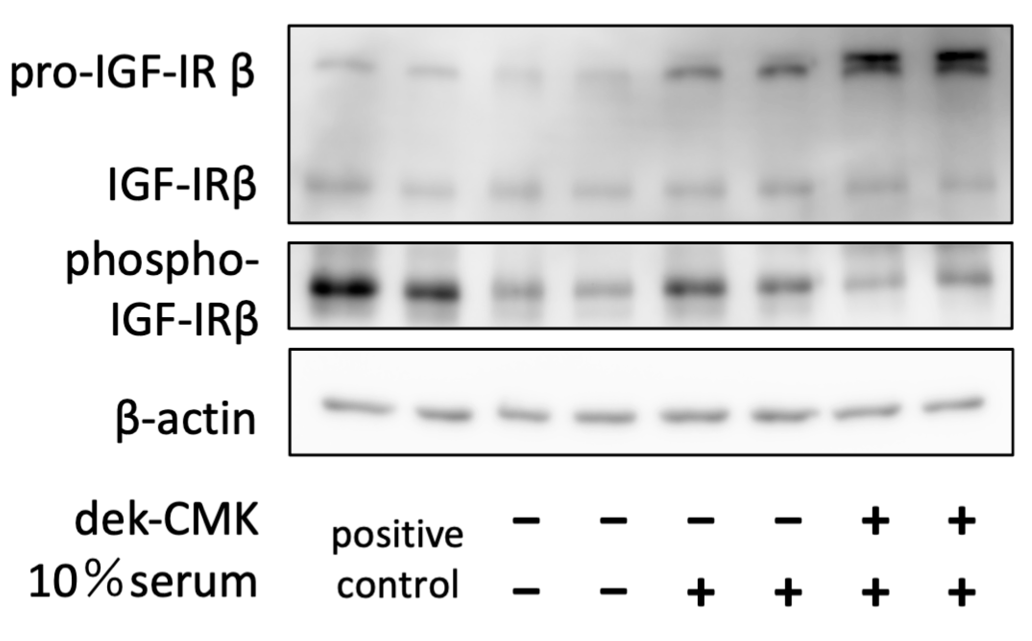 Furin Regulates the Alveolarization of Neonatal Lungs in a Mouse Model ...