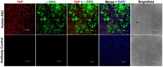 Understanding the Role of Yes-Associated Protein (YAP) Signaling in the ...