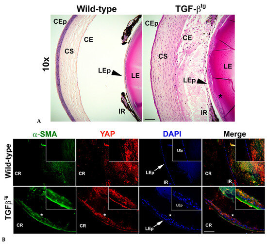 Understanding the Role of Yes-Associated Protein (YAP) Signaling in the ...